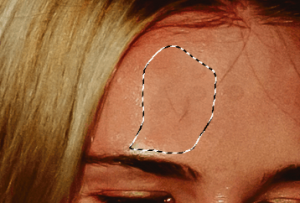 4 Ways to Remove Bright Light in Photoshop (Tutorials)